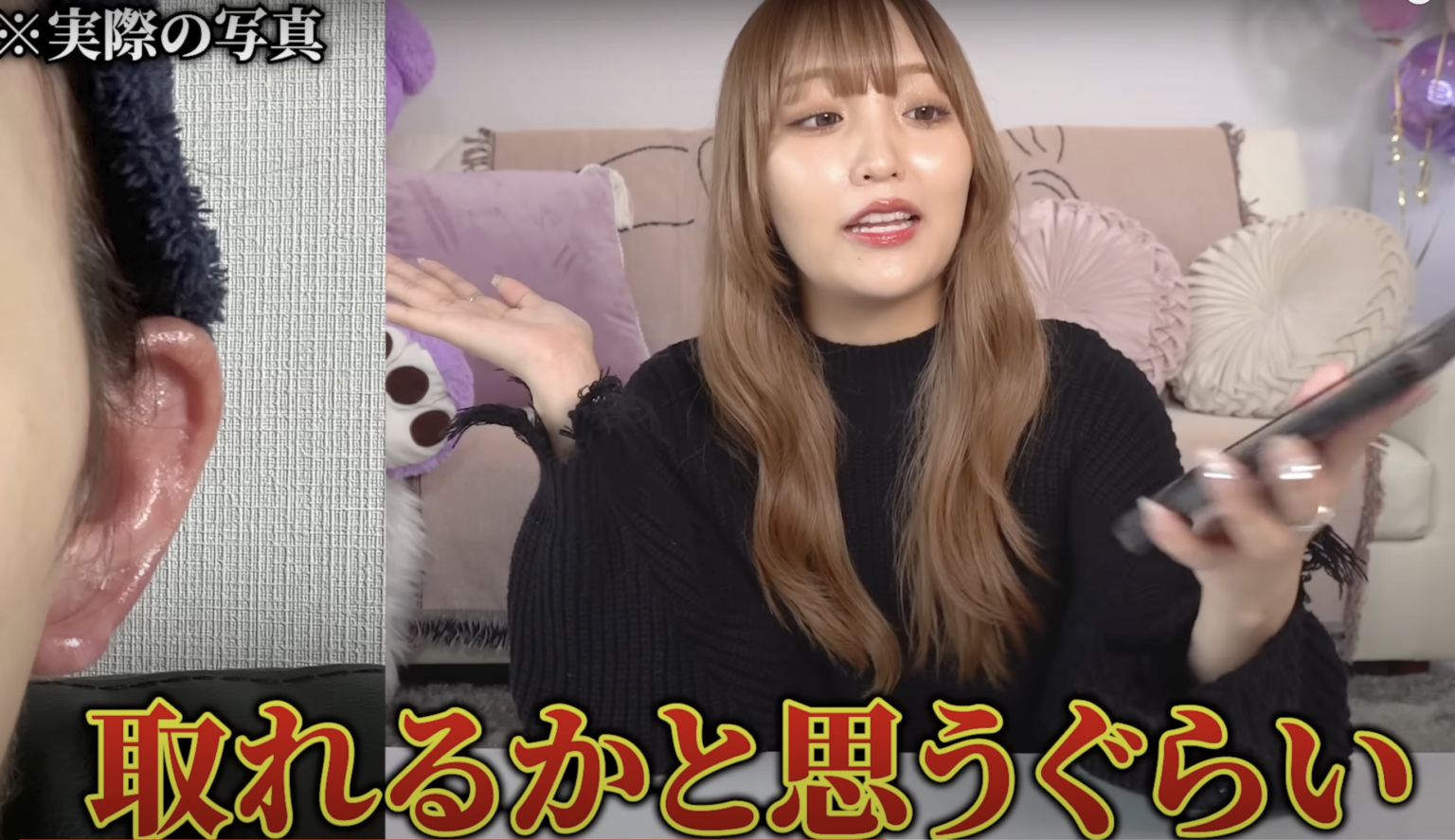 コロナワクチンの広告塔・youtuber『ねお』が、激しい炎症や痒みを伴うアナフィラキシーを発症、「命の危険を感じた」と報告 Rapt理論α